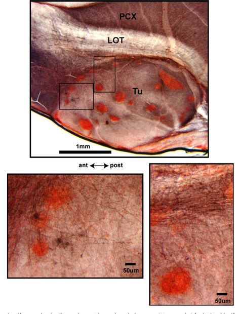 Figure 5 From Sniffing Out The Contributions Of The Olfactory Tubercle