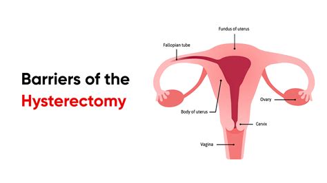 Barriers Of The Hysterectomy Gauri Urogynecology Clinic