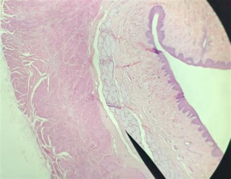 Small Intestine Histology Diagram Quizlet