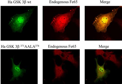 Confocal microscopic analysis of the localization of GSK β wt and its Download Scientific