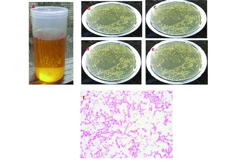 A Collection Of Urine Sample B E E Coli Isolated From Urine