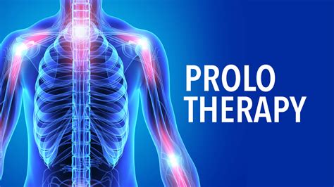Prolotherapy For Pain Relief Functional Medical Institute