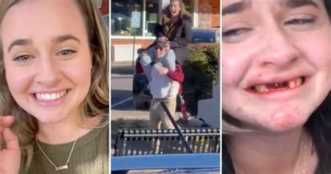 26歲正妹喝茫了 ！爽騎男友「醉後重摔」 門牙慘噴飛 國際 Ctwant