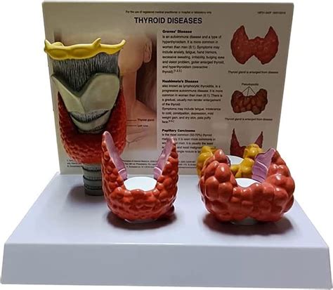 Hiigh Thyroid Anatomy Model Thyroid Nodule Model For