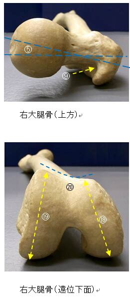 Anatomy Of Humur 大腿骨について（用語、名称、写真、大腿骨に付く筋、大転子、小転子、転子窩に付く筋） トレンドの樹