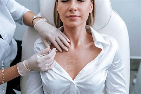 Dermatoscopy Of Skin Lesions And Moles With Dermatoscope For Preventing