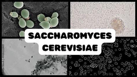 Yeast Cells Microscope View Probiotic Yeast Cells And Saccharomyces