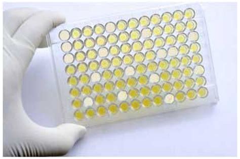 Lsbio Antibodies Proteins Biochemicals Elisa And More