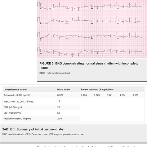 Figure 1 From A Case Of Aortic Valve Infective Endocarditis With Dermatological Findings Of