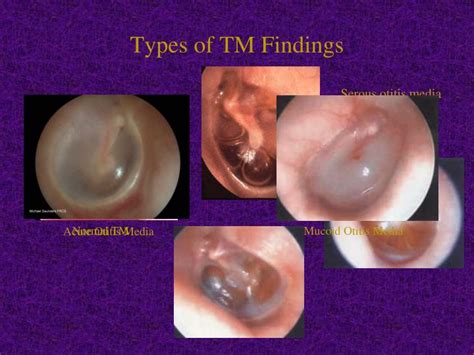 Ppt Middle Ear Powerpoint Presentation Id6762676