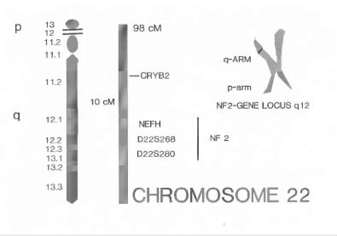 Flanking Markers Indicating Location Of Nf2 Gene In Chromosome 22