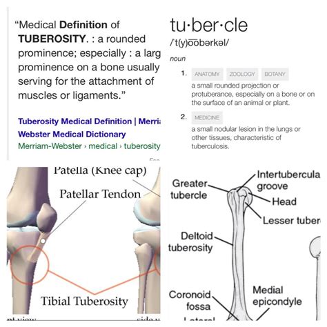 Difference Between Tuberosity And Tubercle Physiology Anatomy Kinesiology