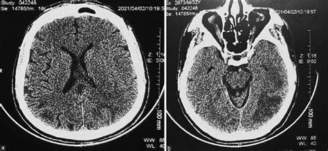 Current Medicine Research And Practice