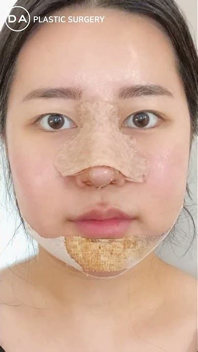 [Бодит өөрчлөлт] Нүүрний хэлбэр засал хамрын мэс засал Youtube