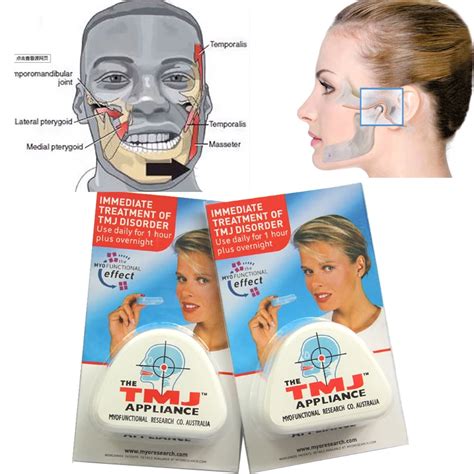 Lateral Pterygoid Release Lupon Gov Ph