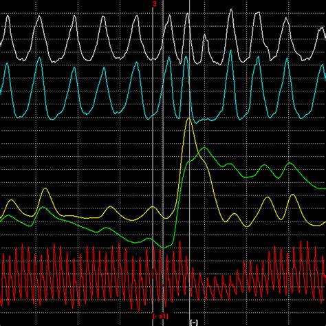 Is A Polygraph A Reliable Lie Detector