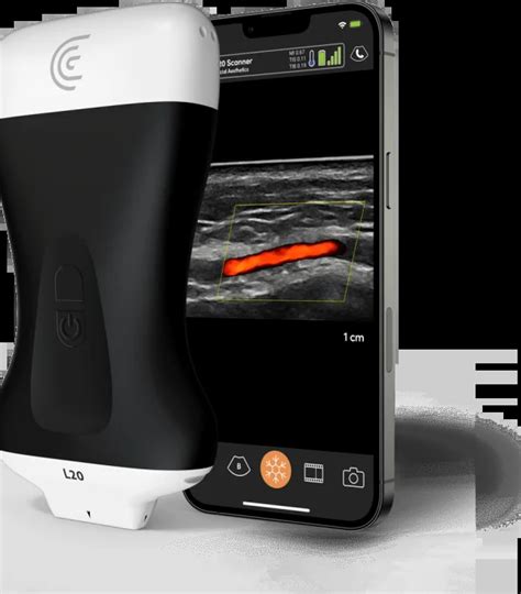 Aesthetic Ultrasound Infinity Aesthetics Doctor Aesthetic Clinic