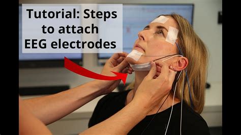 Eeg Electrodes Replacement At Cecil Powell Blog