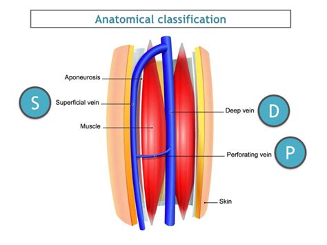 Classification Of Varicose Veins Dr Avinash Katara Minimal Access
