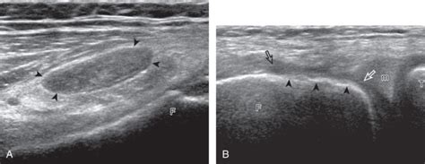 Knee Ultrasound Radiology Key
