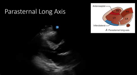 Ive Embedded Some Of The Slides Below However You Should Watch The