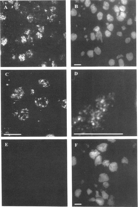 Figure 1 From Nuclear Localization Of The Testis Determining Gene