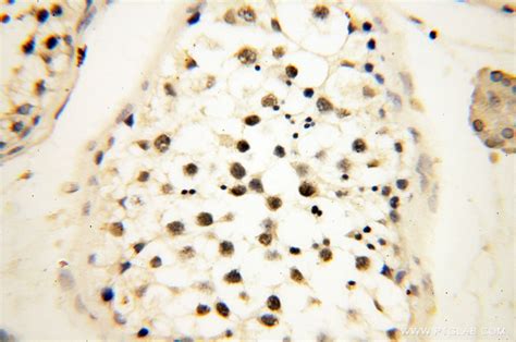 Junb Antibody 10486 1 Ap Proteintech