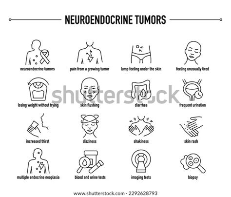 Neuroendocrine Tumors Symptoms Diagnostic Treatment Vector Stock Vector