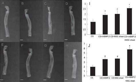 Figure From Combined Mesenchymal Stem Cell Sheets And RhBMP Releasing Calcium SulfaterhBMP