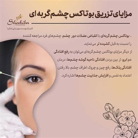 بوتاکس چشم گربه‌ ای چیست؟ ️ نقاط تزریق عکس
