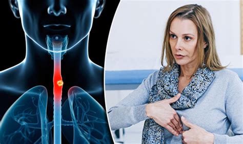 Oesophageal Cancer Symptoms Signs Of Cancer Of The Gullet Uk