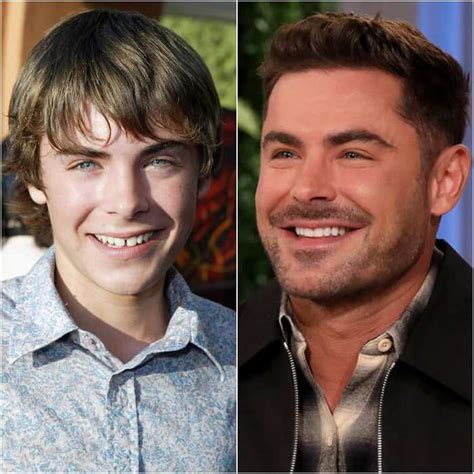 Revealing Before And After How Alist Celebs Have Transformed Over The