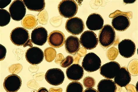 Typical Partial Infection Of Wheat Kernels With Smut Fungus Tilletia Download Scientific