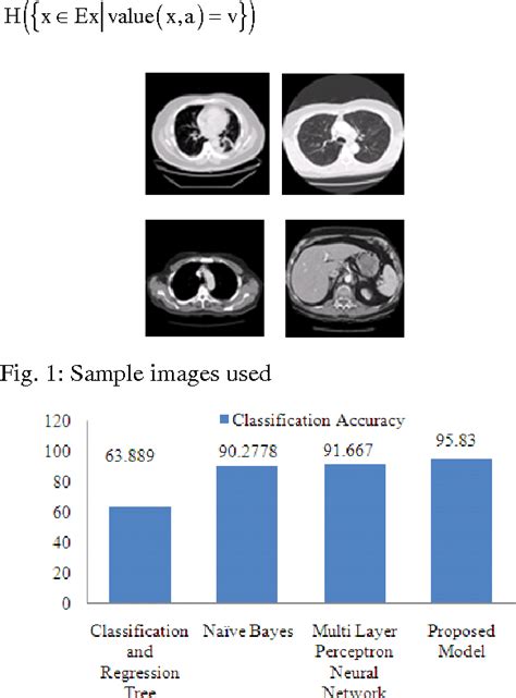 Figure 1 From Content Based Image Retrieval Using Novel Gaussian Fuzzy Feed Forward Neural