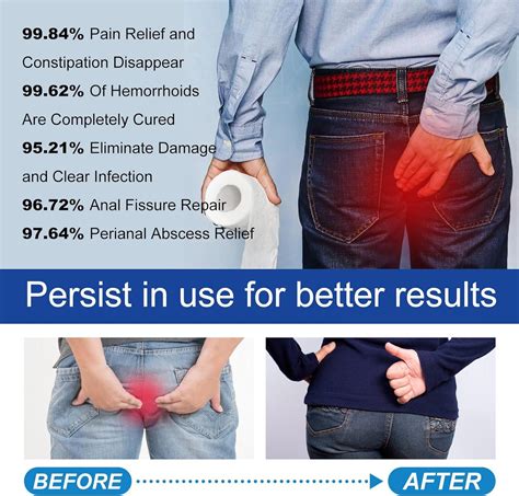 Drelene Heca Natural Herbal Strength Hemorrhoid Capsules Natural