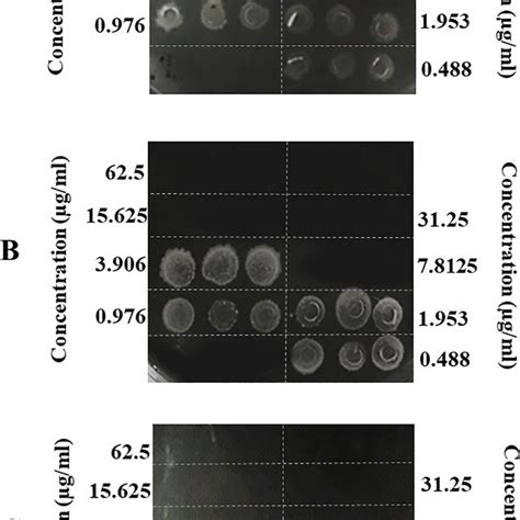 Membrane Structure Of C Difficile Via Transmission Electron