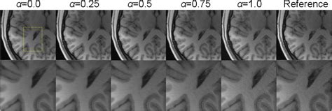 Figure 5 From Enhanced Generative Adversarial Network For 3d Brain Mri Super Resolution