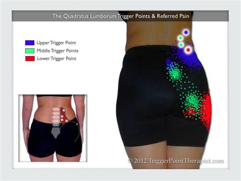 Quadratus Lumborum Physiopedia