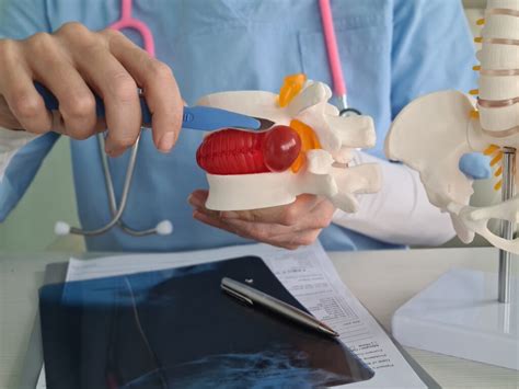 Recovery After Lumbar Decompression Surgery Neurospine Plus