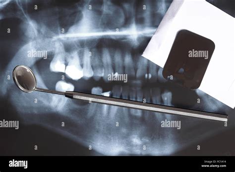 X Ray Scan Of Humans Teeth Stock Photo Alamy