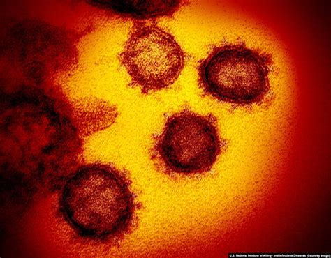 Virus Electron Micrograph