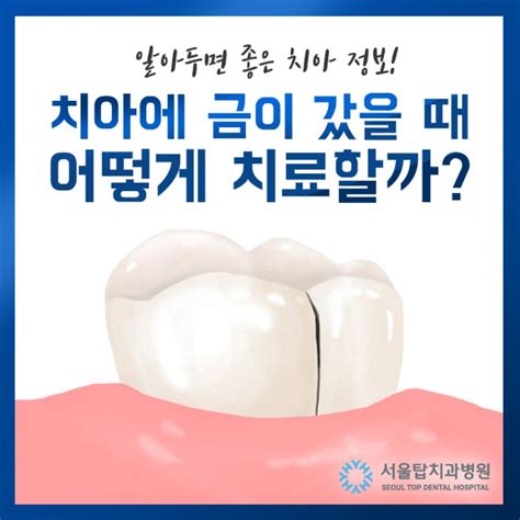 치아에 금이 갔을 때 어떻게 치료할까 네이버 블로그