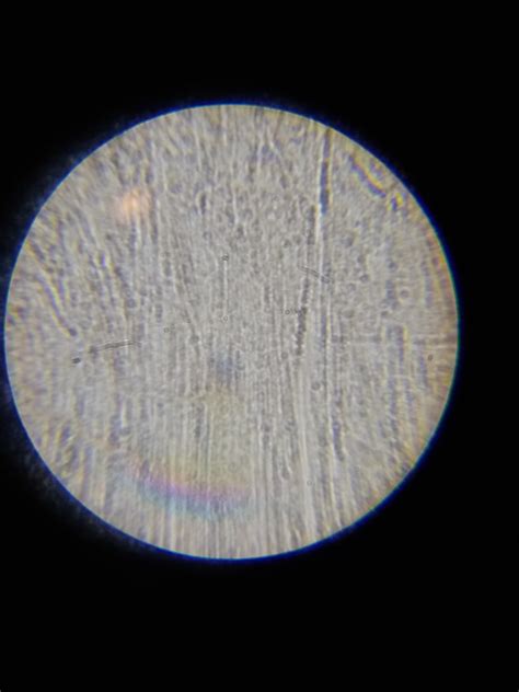This Is What 1000x Magnification Looks Like For Me With Nothing Under