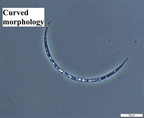 Cylindrospermopsis Cyanobacteria Guide