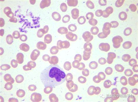 红细胞缗钱状排列居然是因为“他