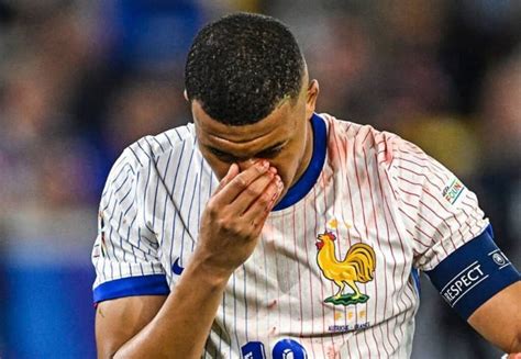 EdF la première image de Kylian Mbappé avec son masque fait fureur