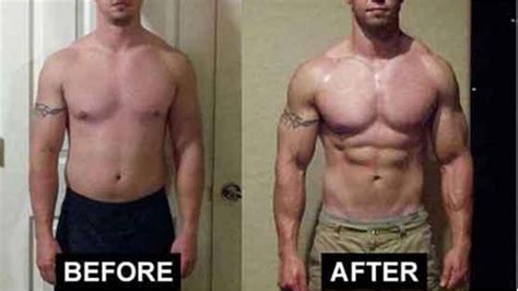 Unbelievable Rad Results See The Before After Photos