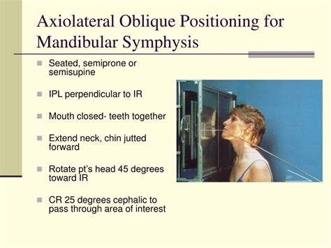 Mandible X Ray Position Examquiz