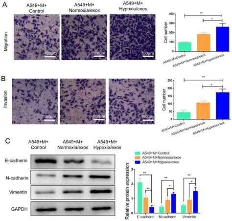 Hypoxic Tumor Derived Exosomes Induce M2 Macrophage Polarization Via