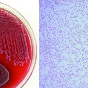 Pdf Elizabethkingia Meningoseptica Peritonitis In Continuous